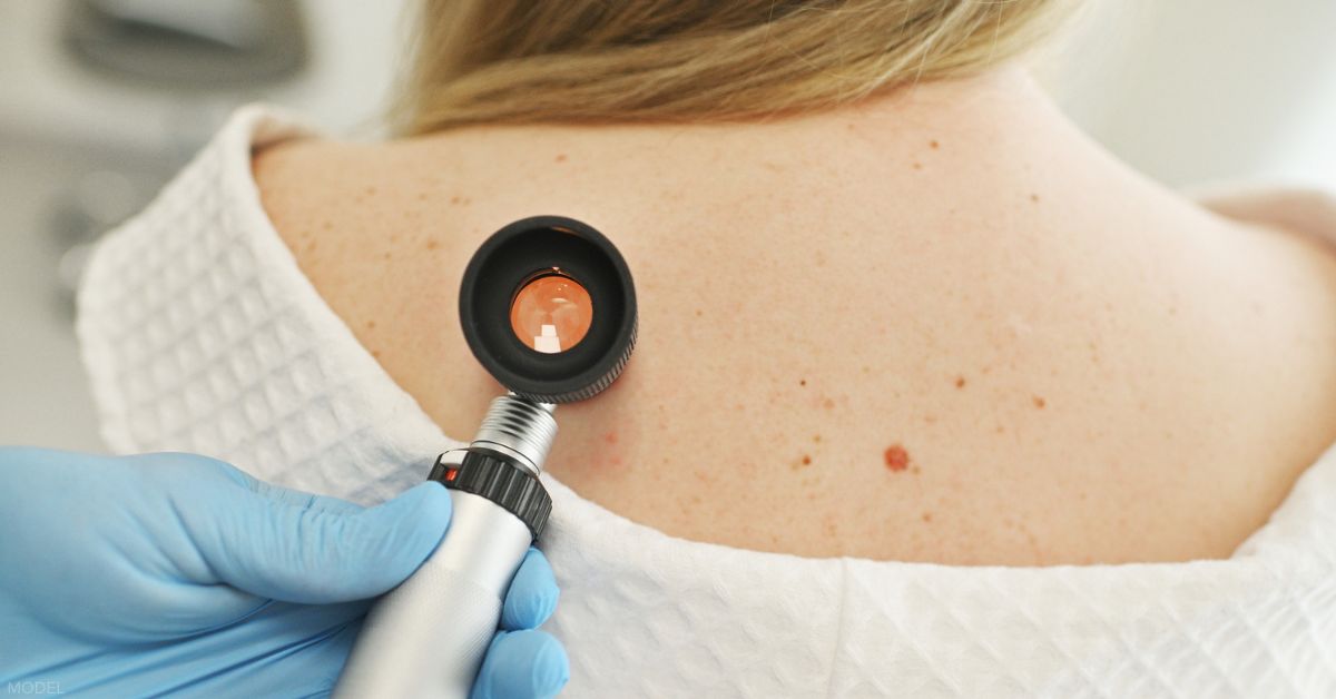 The Importance of Total Body Skin Checks – The Clinic for Dermatology ...